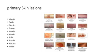 2. Terminology of skin lesions slide share.pptx