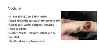 2. Terminology of skin lesions slide share.pptx