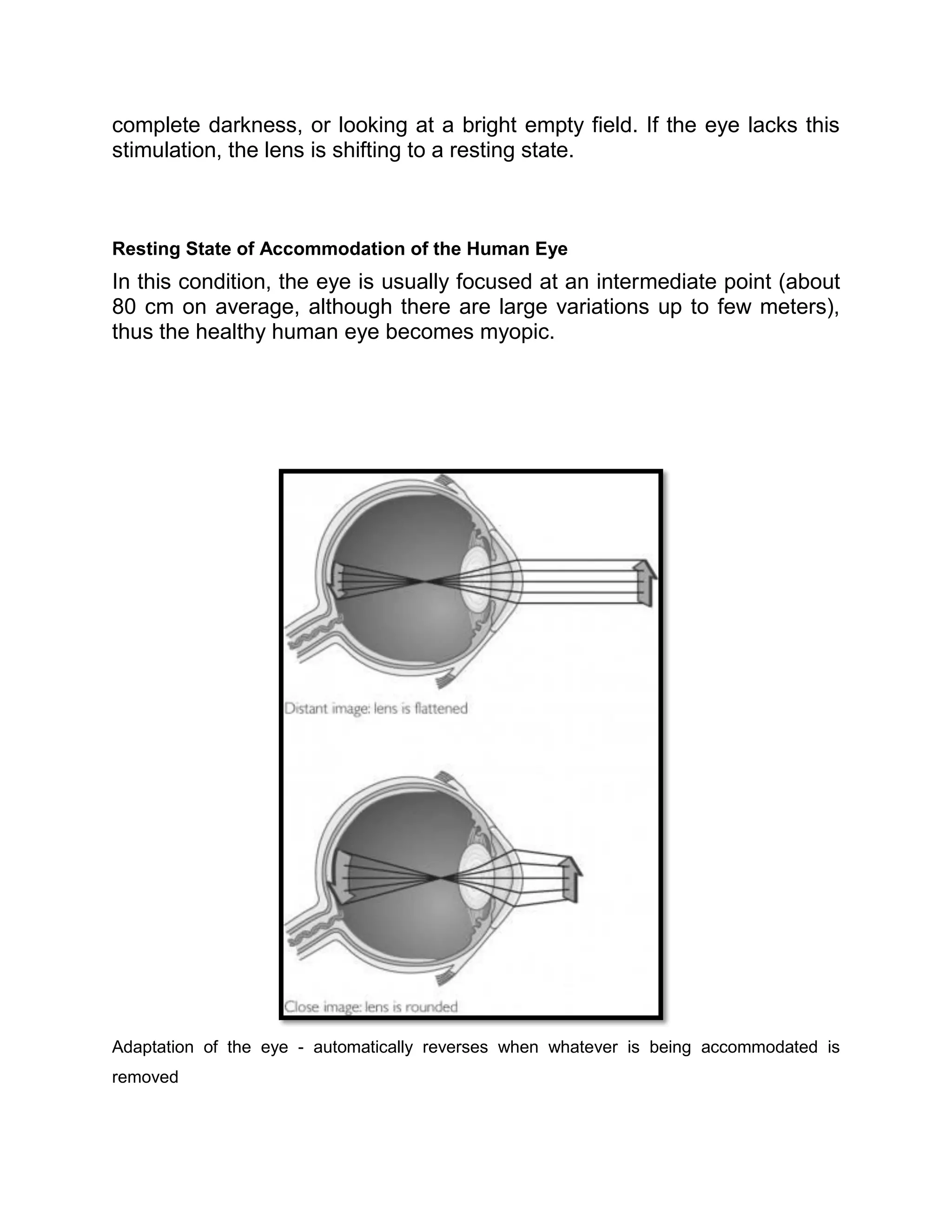 empty space myopia | PDF
