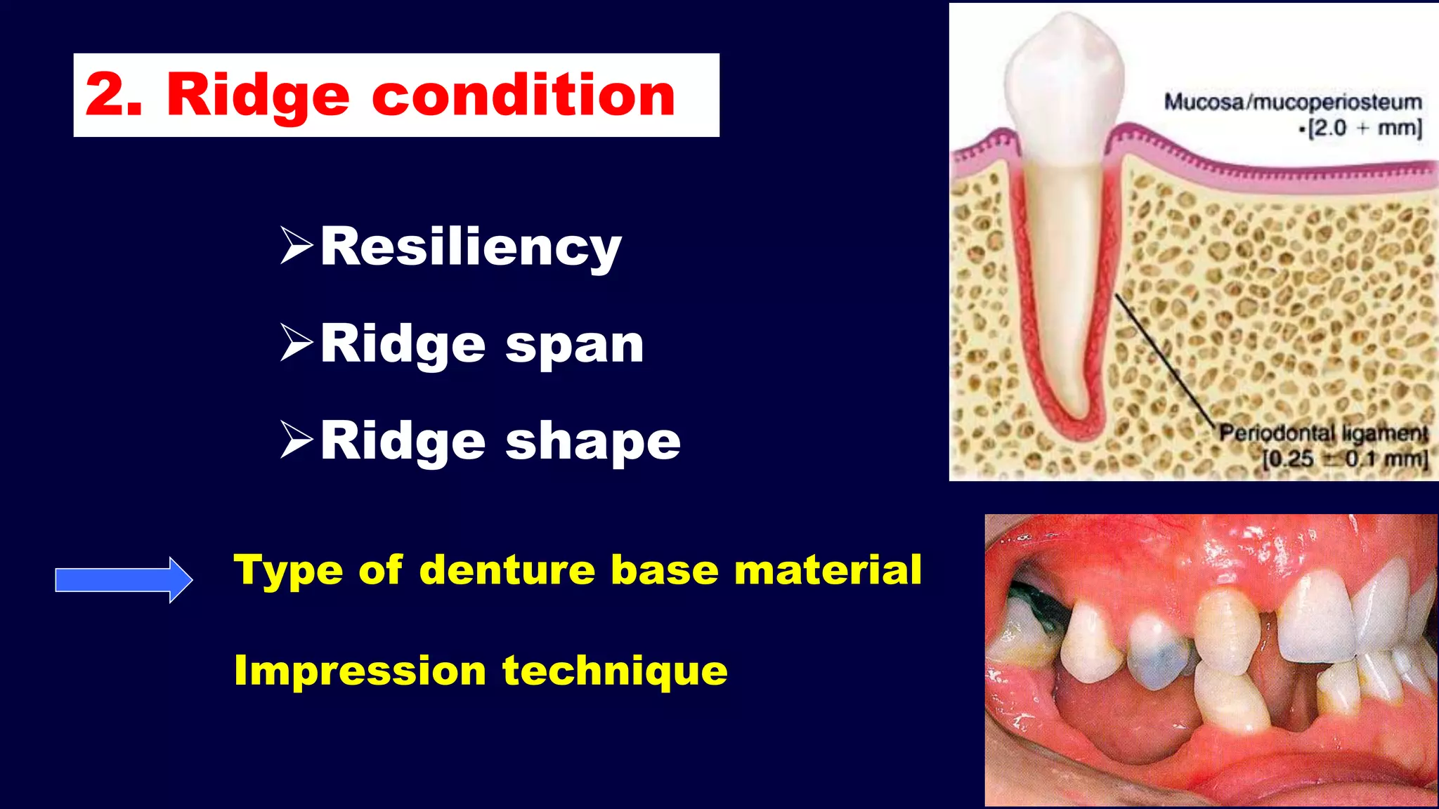 2- a. Basic principles for designing the removable partial denture ...