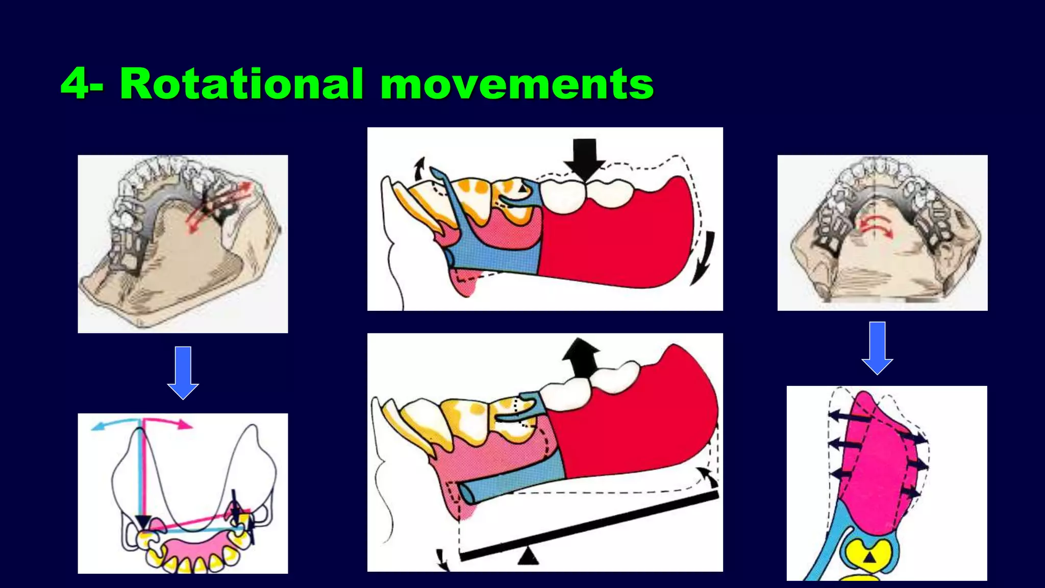2- a. Basic principles for designing the removable partial denture ...