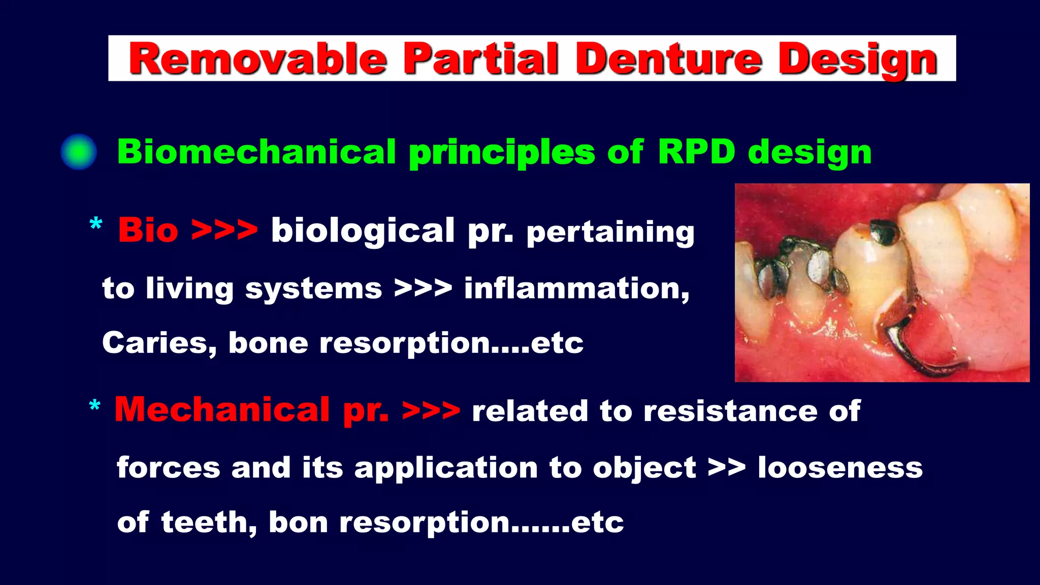 2- a. Basic principles for designing the removable partial denture ...