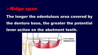 2- a. Basic principles for designing the removable partial denture (class I partial denture ...