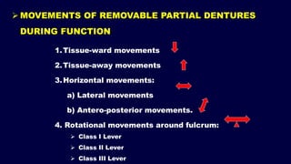 2- a. Basic principles for designing the removable partial denture ...