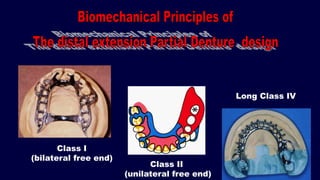2- a. Basic principles for designing the removable partial denture ...