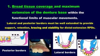 2- a. Basic principles for designing the removable partial denture ...