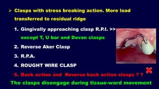 2- a. Basic principles for designing the removable partial denture ...