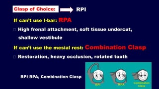 2- a. Basic principles for designing the removable partial denture ...