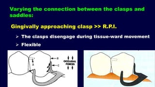 2- a. Basic principles for designing the removable partial denture ...