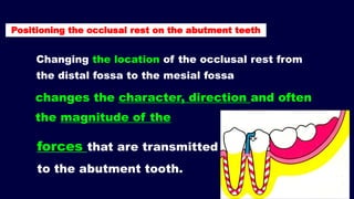 2- a. Basic principles for designing the removable partial denture ...