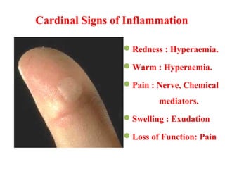 2 acute inflammation | PPT