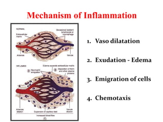 acute inflammation | PPT