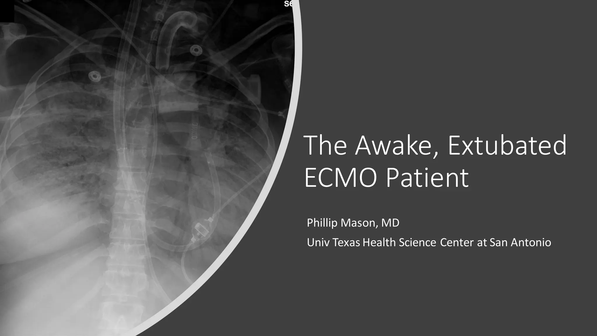 2 - Advanced ECMO Management Strategies.pdf | Heart and Cardiovascular Diseases | Diseases and ...