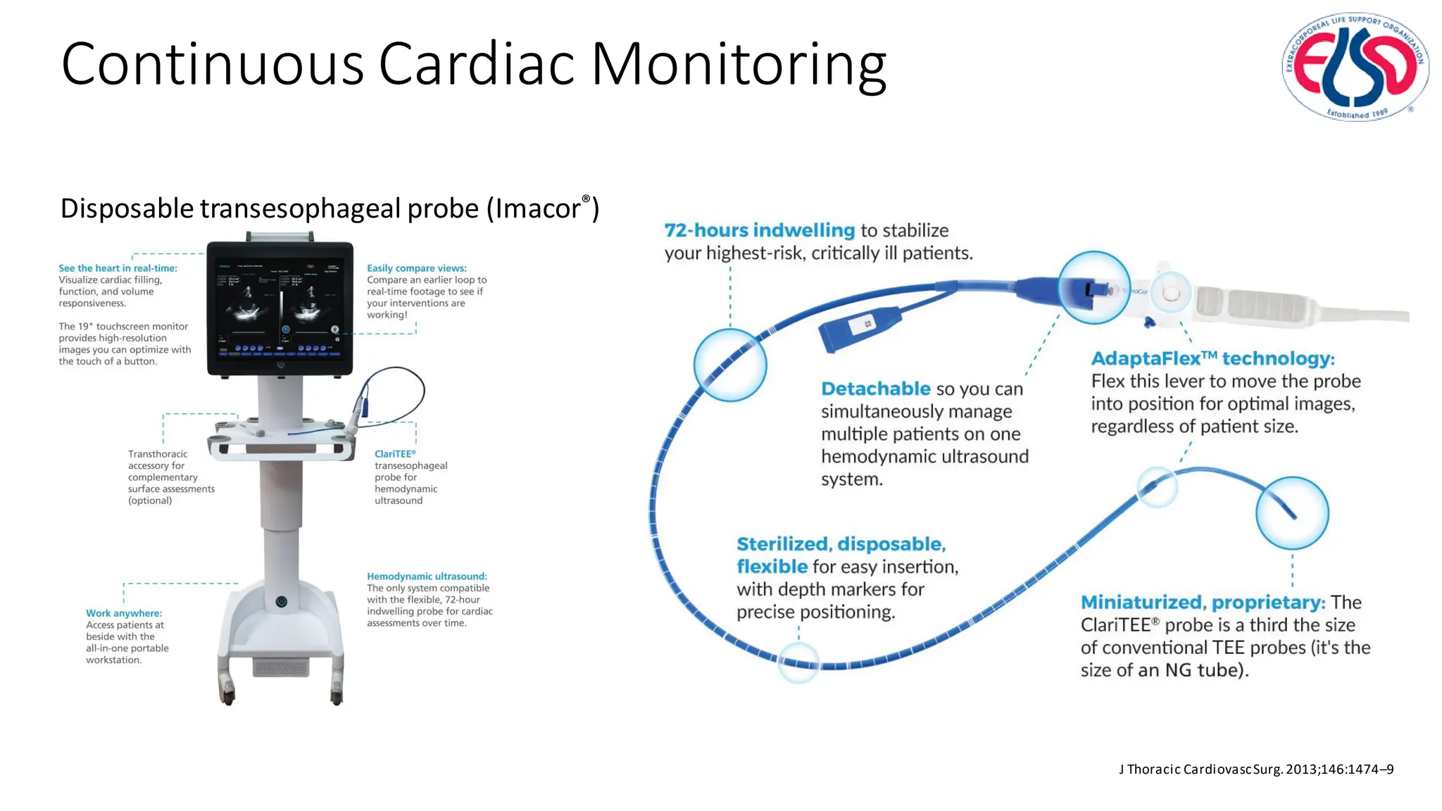 2 - Advanced ECMO Management Strategies.pdf | Heart and Cardiovascular ...