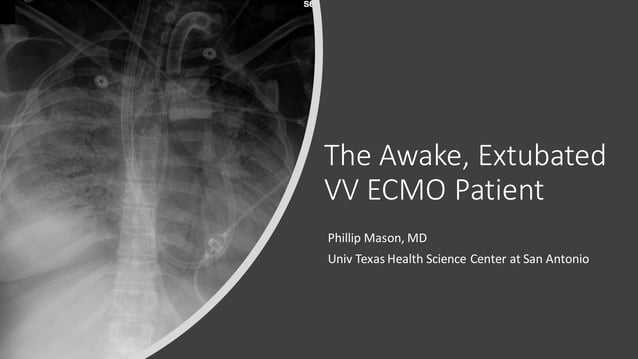 2 - Advanced ECMO Management Strategies.pdf | Heart and Cardiovascular ...
