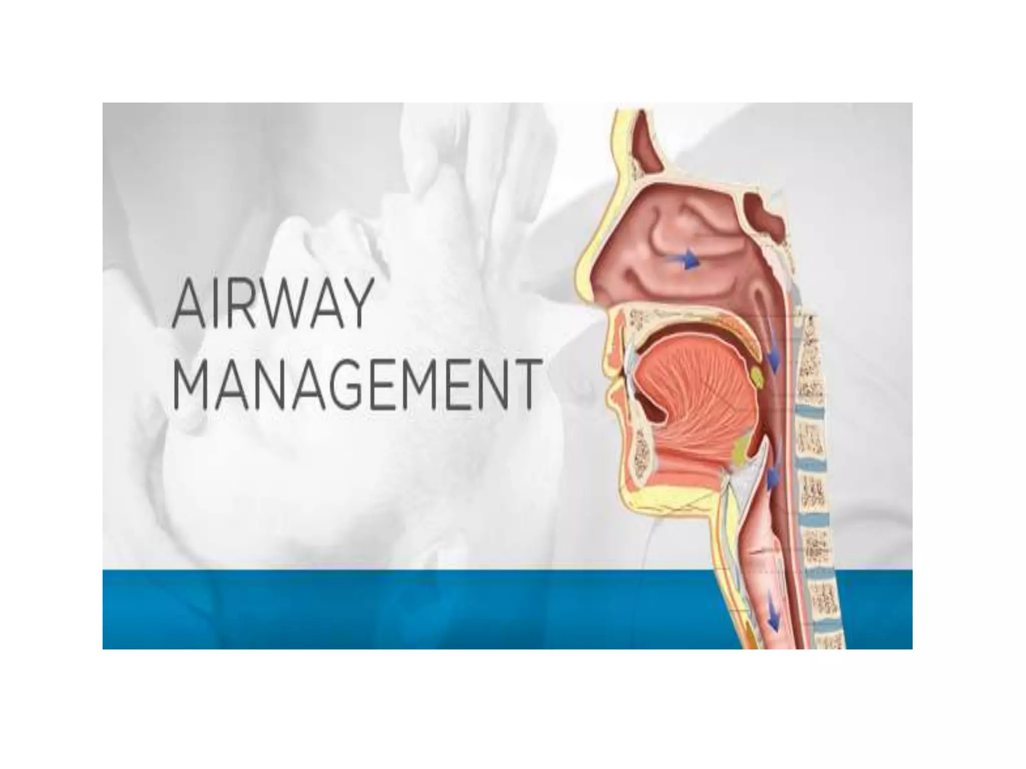 Airway Emergencies - by Dr. Ahmed Azab - ER consultant | PPTX