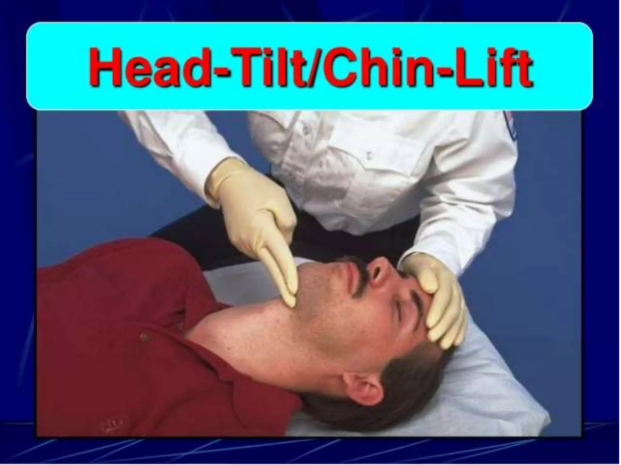 Airway Emergencies - by Dr. Ahmed Azab - ER consultant | PPT