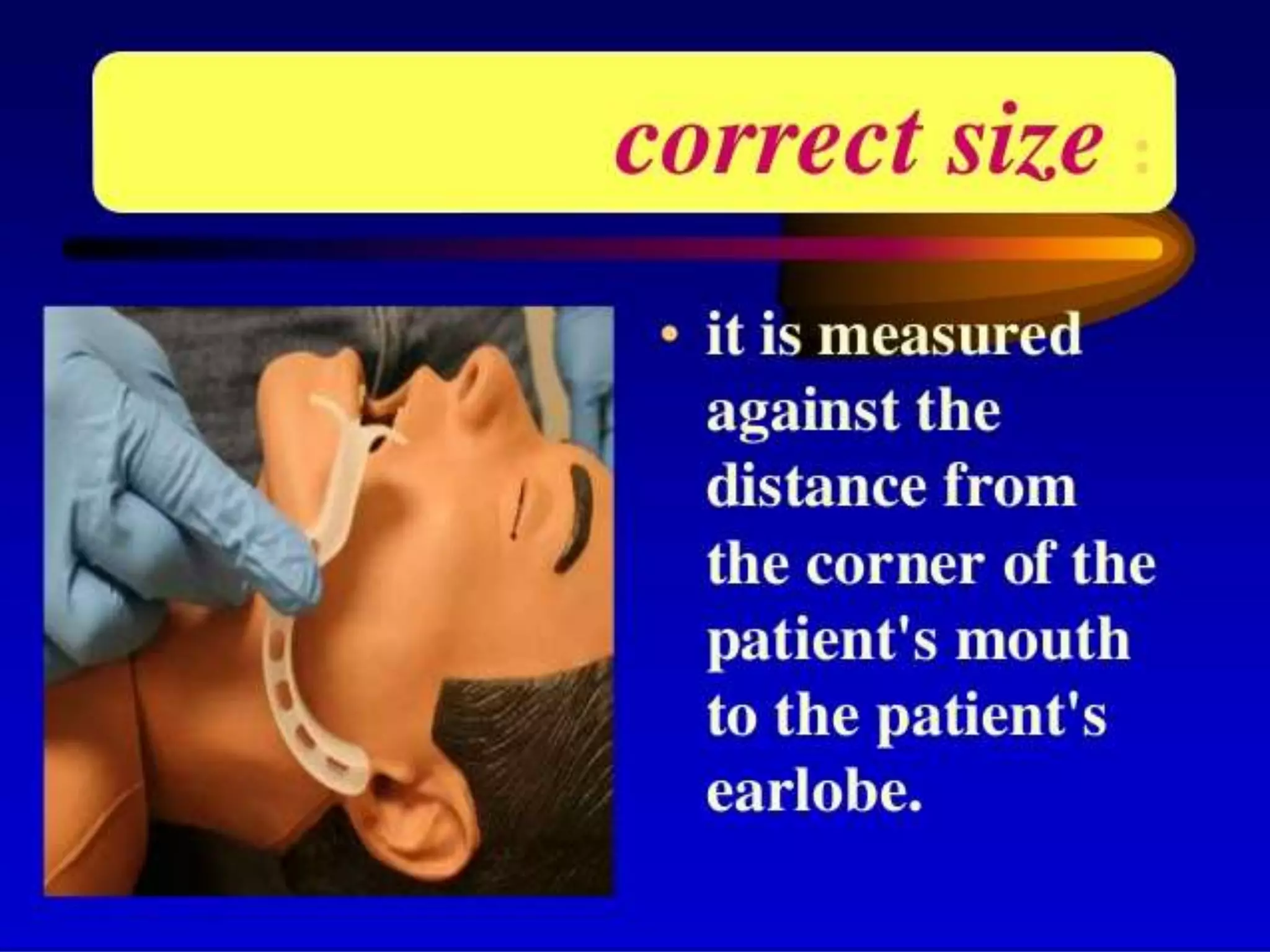Airway Emergencies - by Dr. Ahmed Azab - ER consultant | PPT