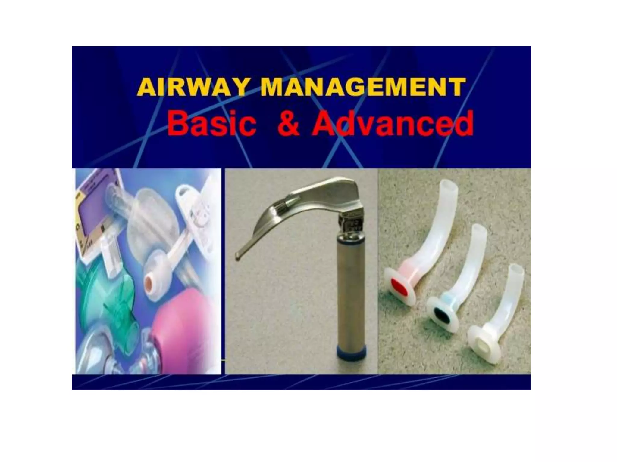 Airway Emergencies - by Dr. Ahmed Azab - ER consultant | PPT