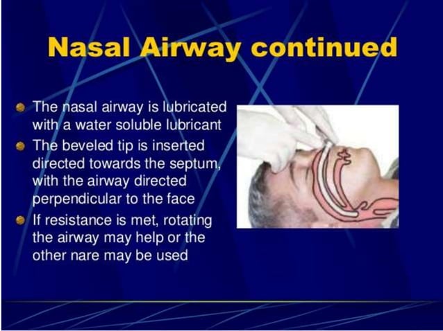 Airway Emergencies - by Dr. Ahmed Azab - ER consultant | PPT