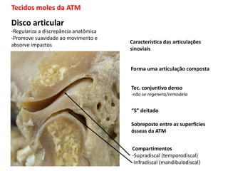 ATM AULA DE ANATOMIA DA ART. TEMPOROMANDI | PDF