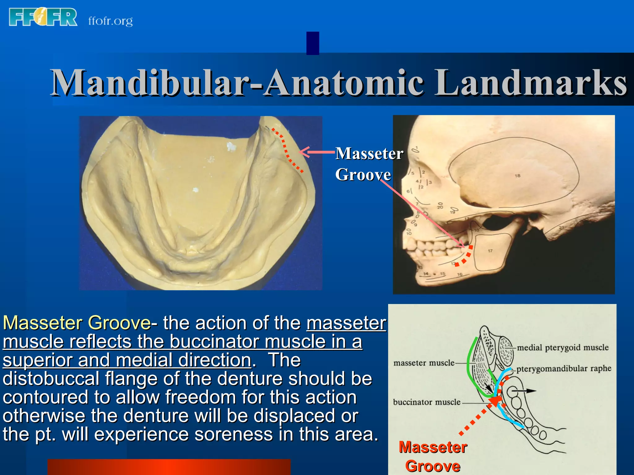 2.anatomy of the denture foundation areas | PPT