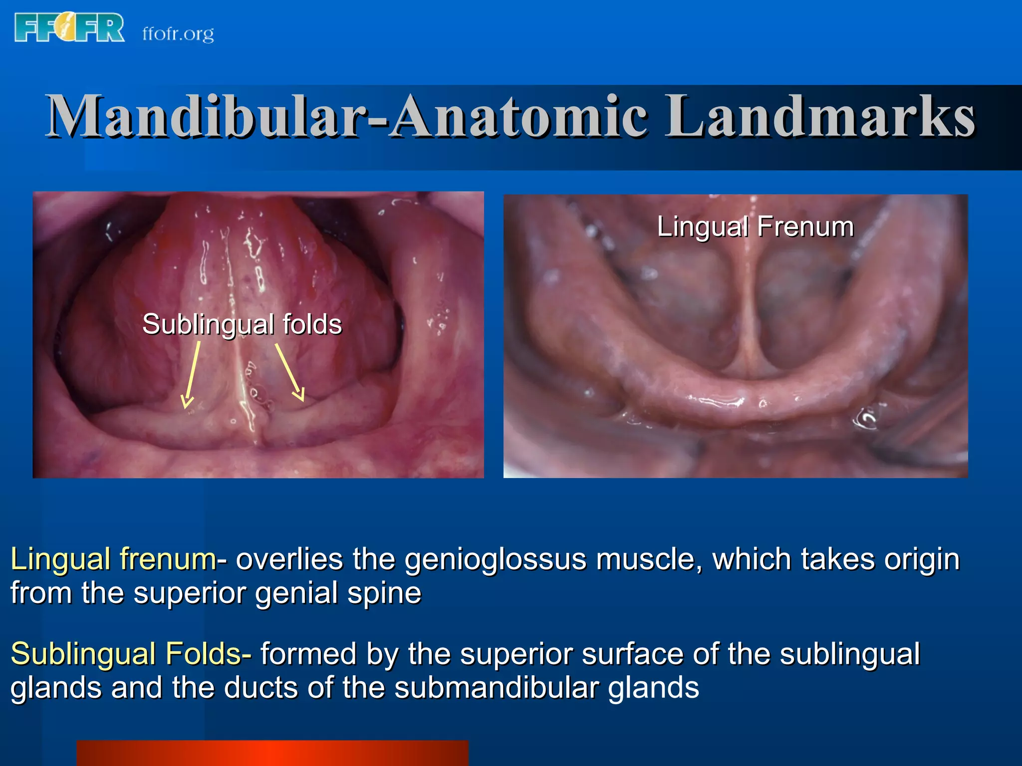 2.anatomy of the denture foundation areas | PPT