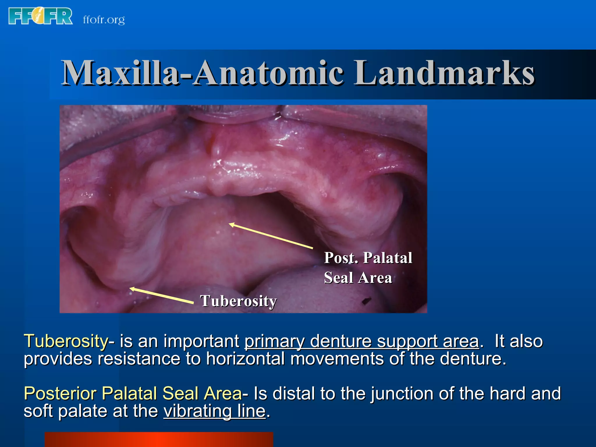 2.anatomy of the denture foundation areas | PPT