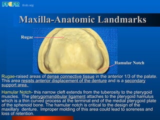 2.anatomy of the denture foundation areas | PPT