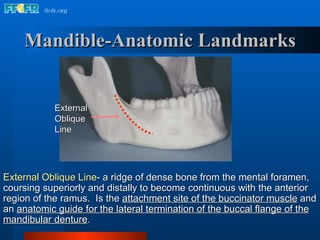 Oblique Line Of Mandible