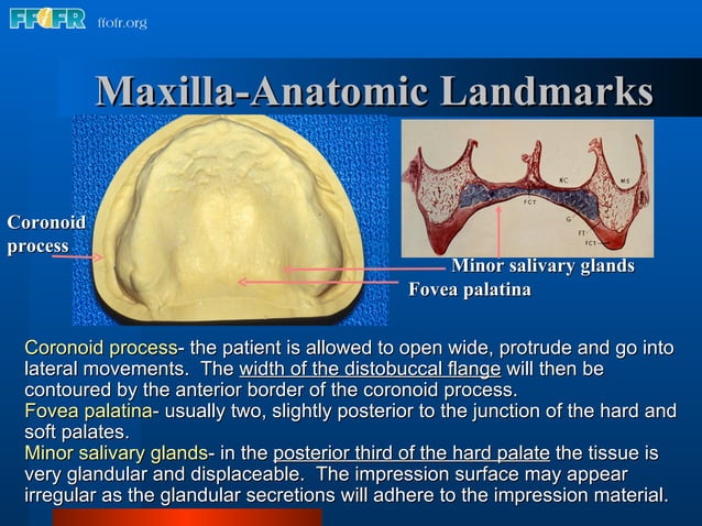 2.anatomy of the denture foundation areas