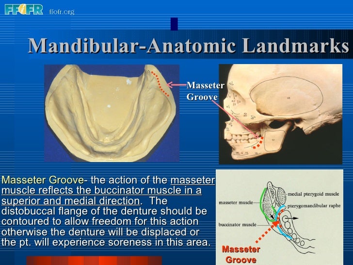 2.anatomy of the denture foundation areas