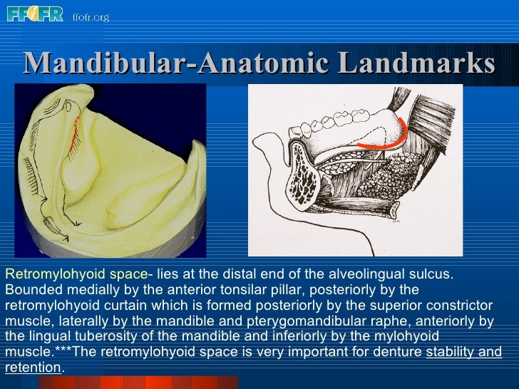 2.anatomy of the denture foundation areas