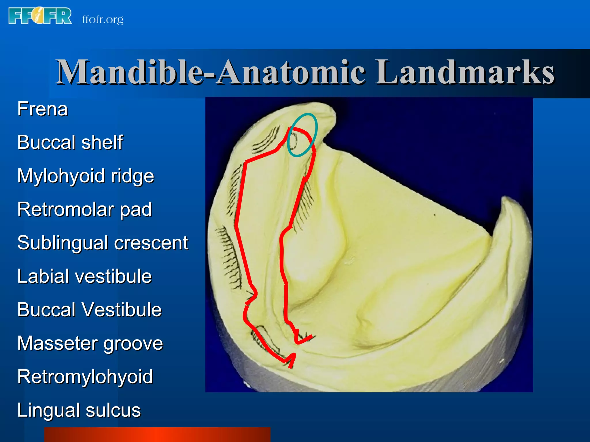 2.anatomy of the denture foundation areas | PPT