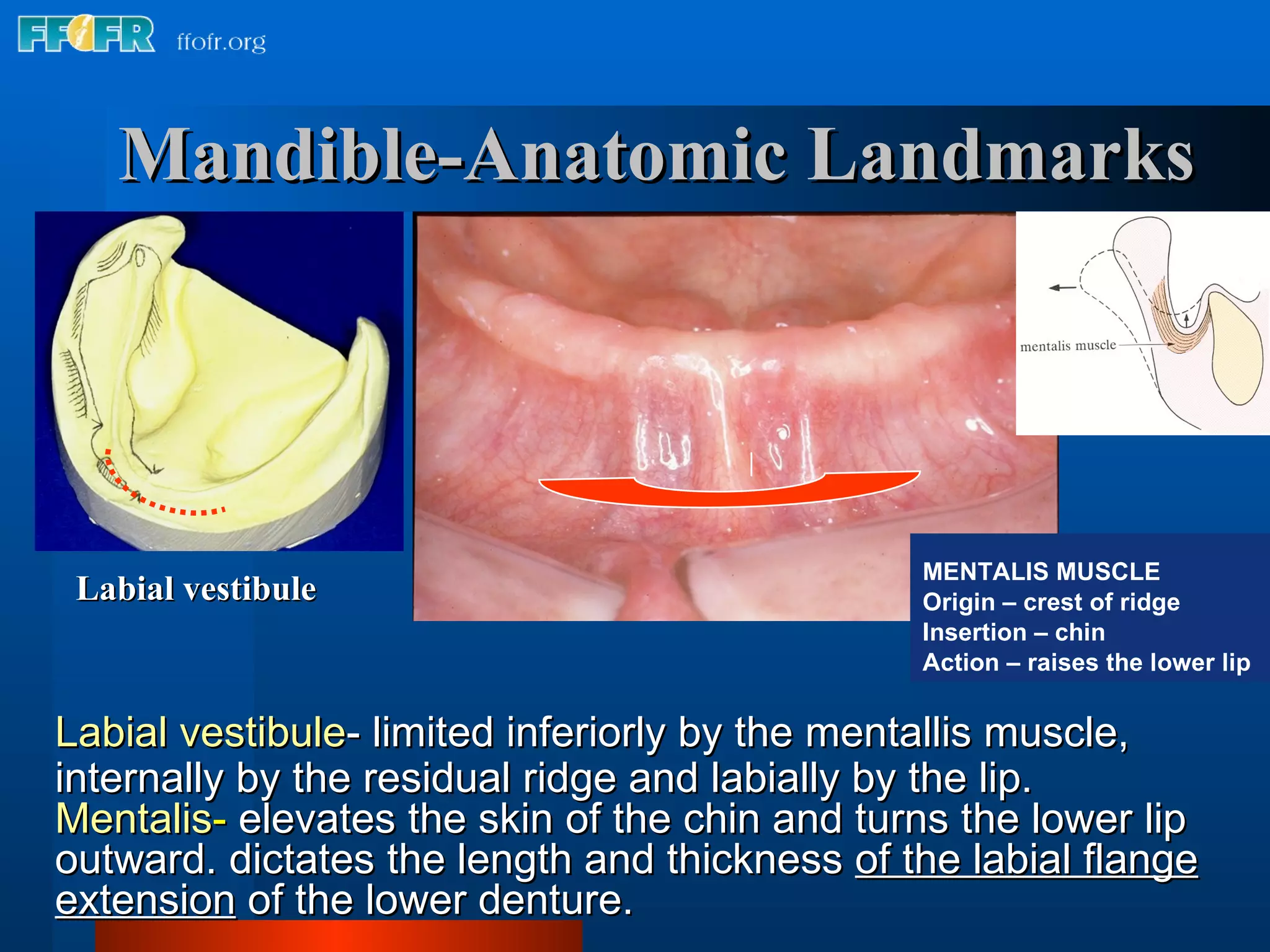 2.anatomy of the denture foundation areas | PPT