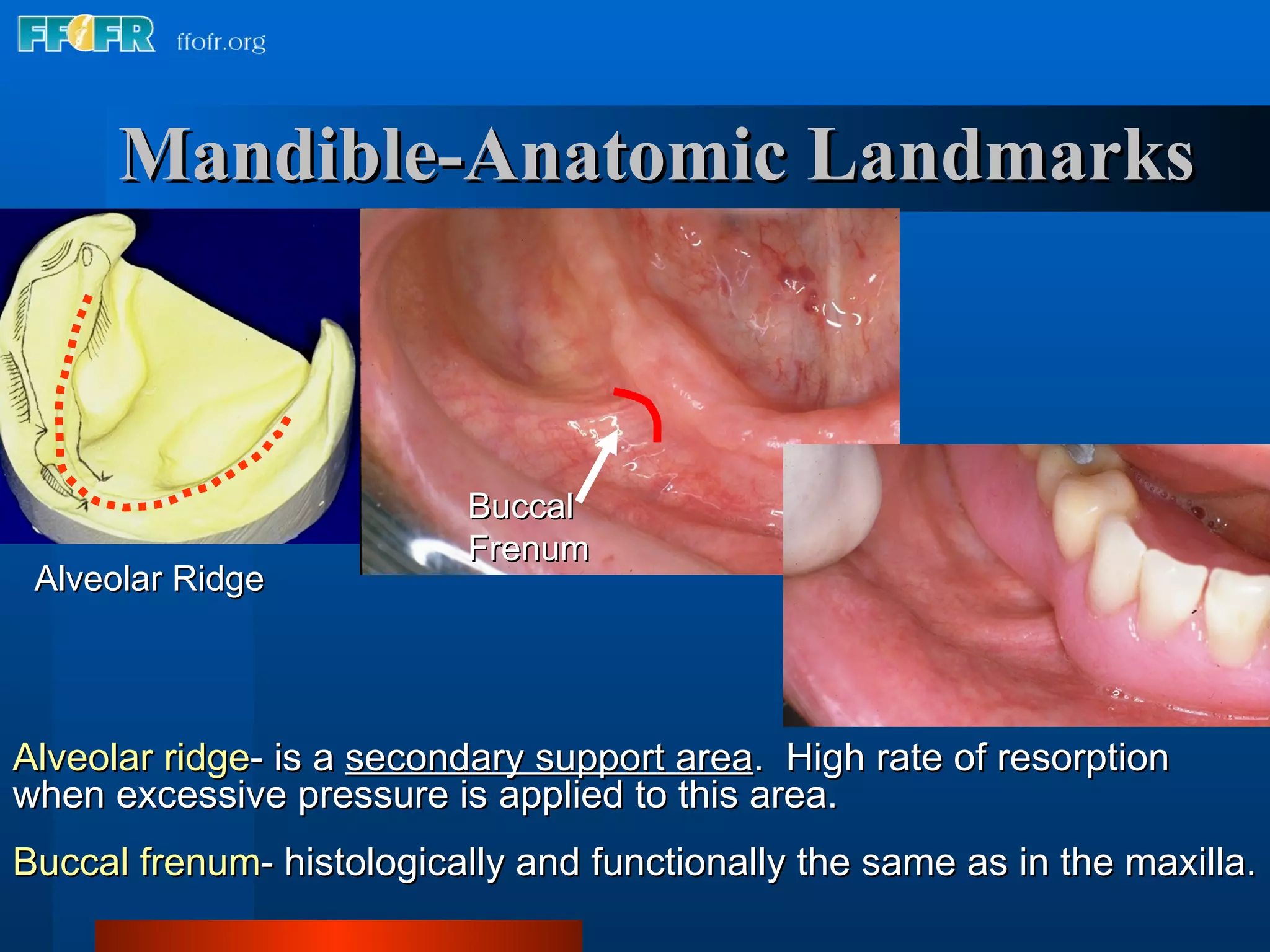 2.anatomy of the denture foundation areas | PPT