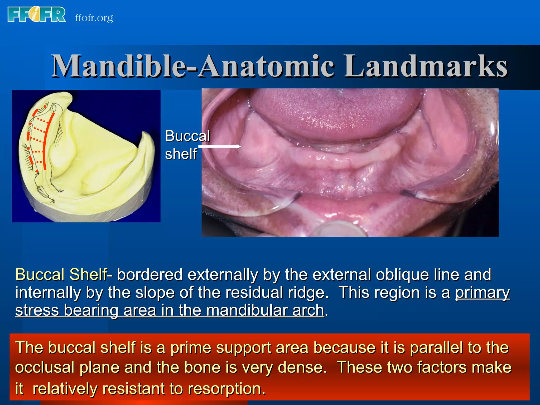 2.anatomy of the denture foundation areas | PPT