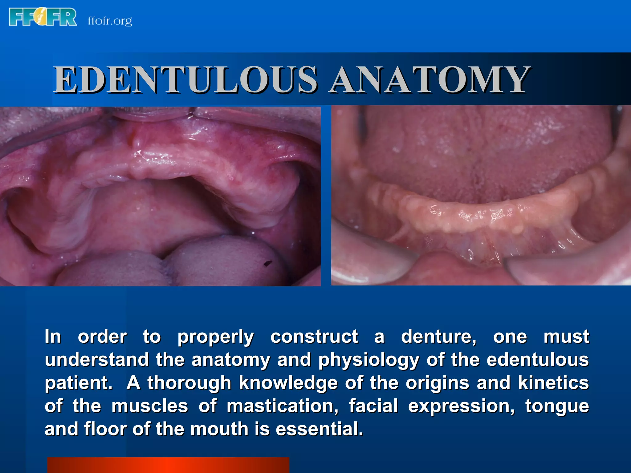 2.anatomy of the denture foundation areas | PPT