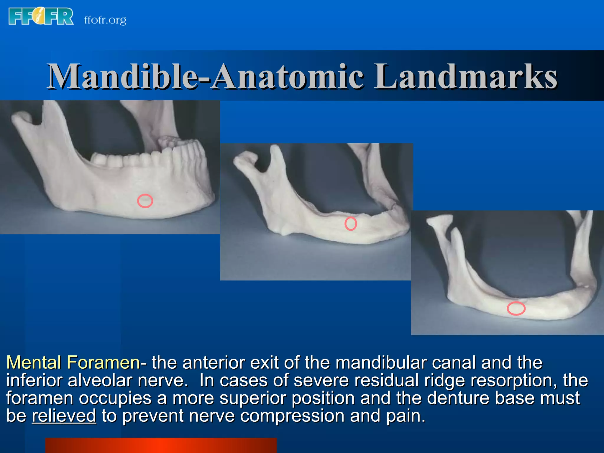 2.anatomy of the denture foundation areas | PPT