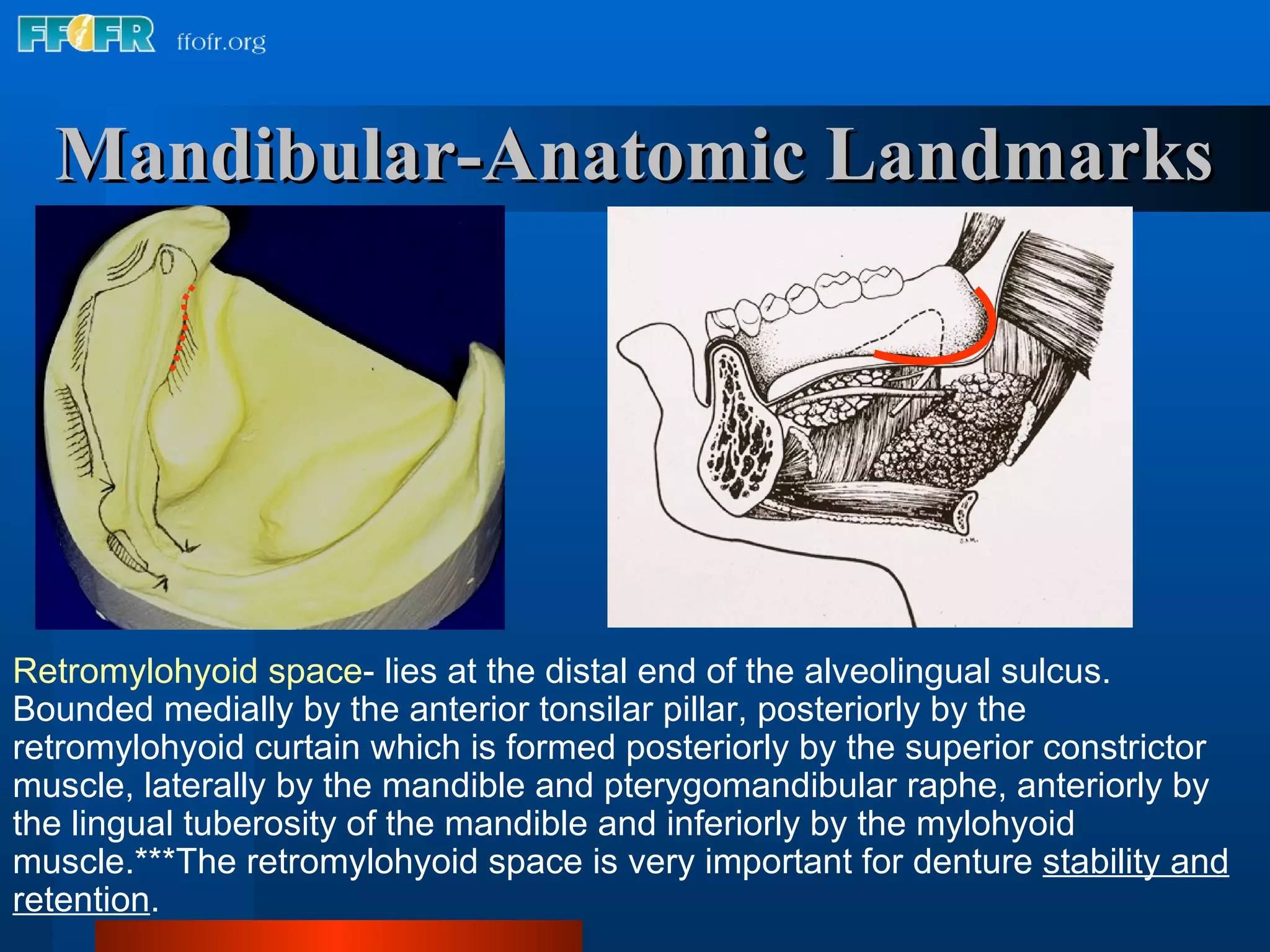 2.anatomy of the denture foundation areas | PPT