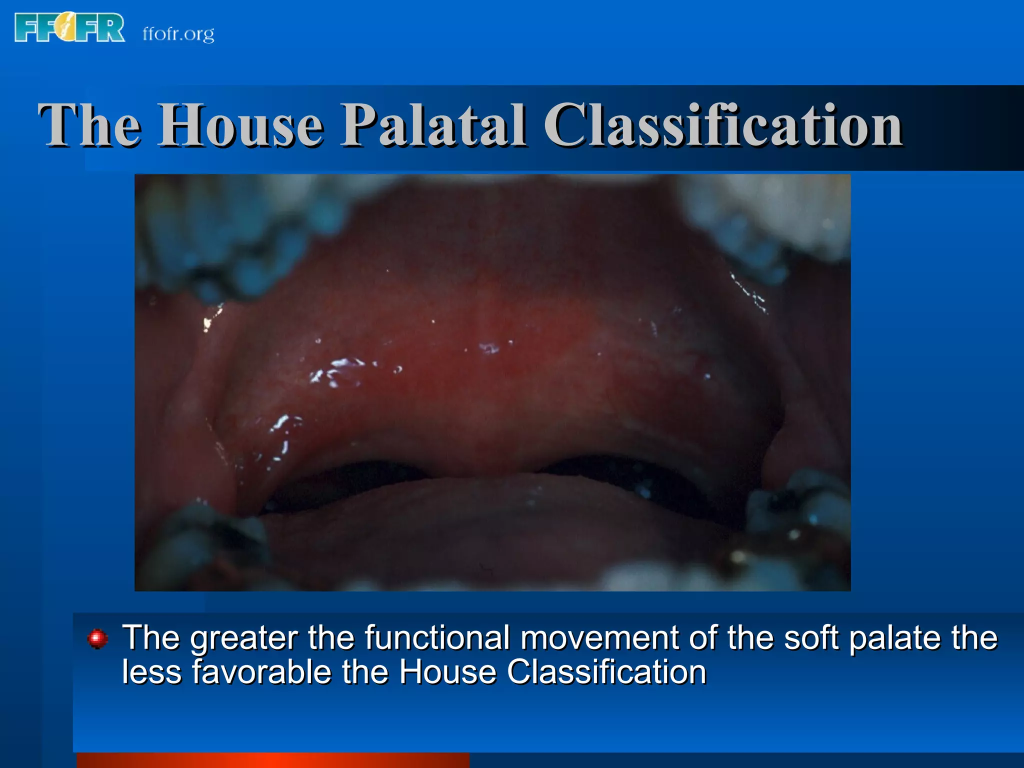 2.anatomy of the denture foundation areas | PPT