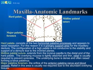 2.anatomy of the denture foundation areas | PPT