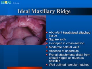 2.anatomy of the denture foundation areas | PPT