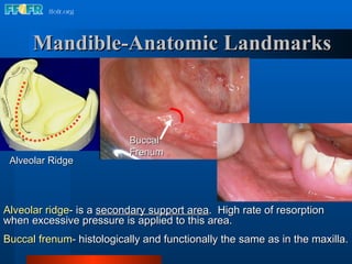 2.anatomy of the denture foundation areas | PPT