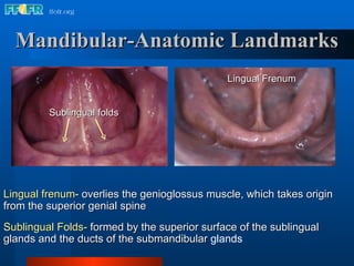 2.anatomy of the denture foundation areas | PPT