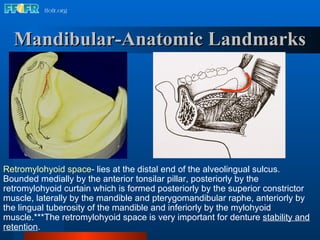 2.anatomy of the denture foundation areas | PPT
