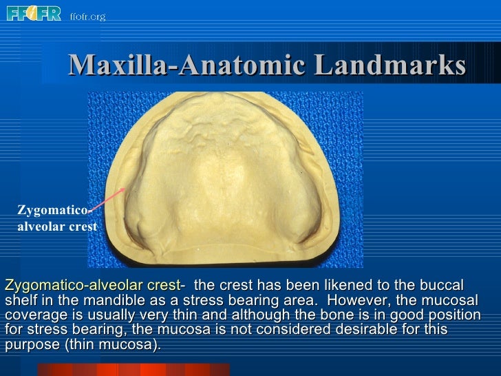 2.anatomy of the denture foundation areas