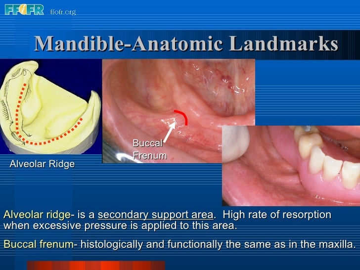 2.anatomy of the denture foundation areas