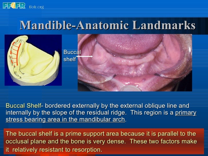 2.anatomy of the denture foundation areas