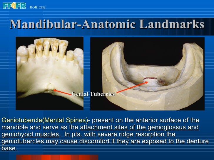 2.anatomy of the denture foundation areas
